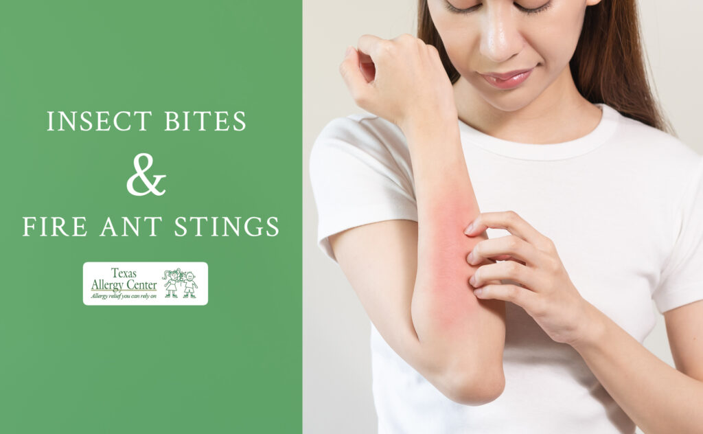 Insect Bites and Fire Ant Stings - Texas Allergy Center
